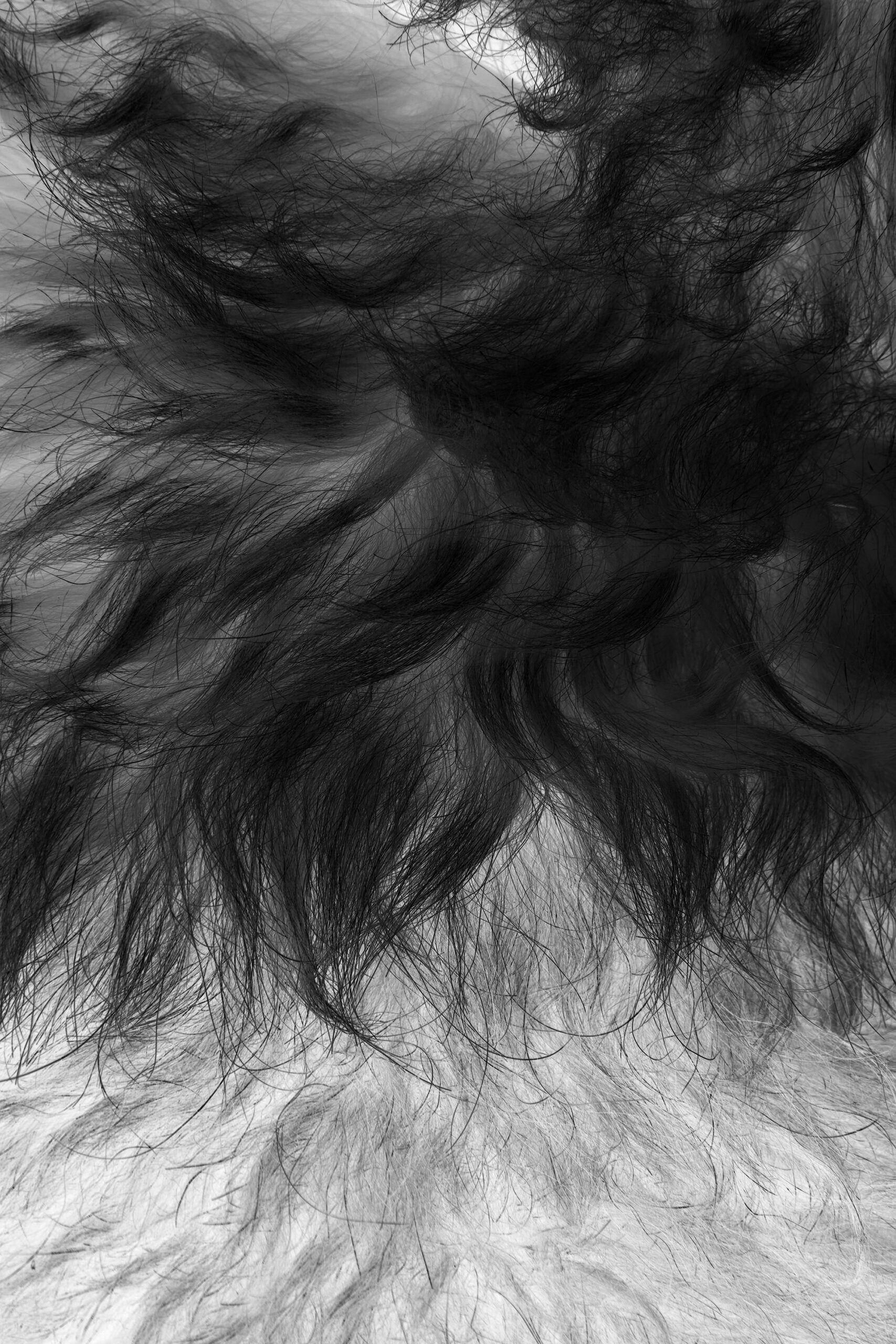 Dutasteryd – leczenie łysienia androgenowego - F E M E A | Klinika Kobiet